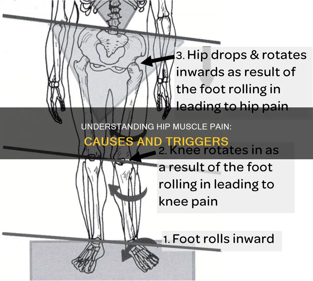 Understanding Hip Muscle Pain: Causes And Triggers | CyVigor