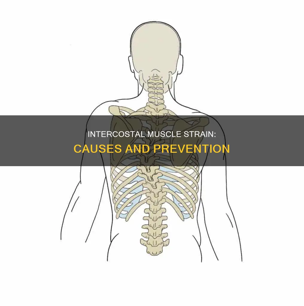 Intercostal Muscle Strain: Causes And Prevention | CyVigor