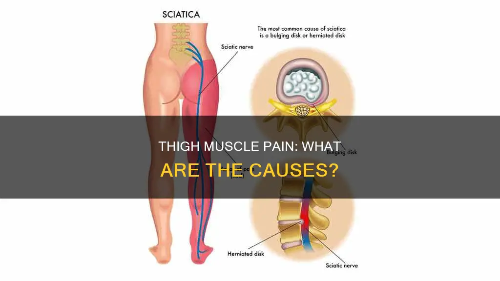 Thigh Muscle Pain: What Are The Causes? | CyVigor