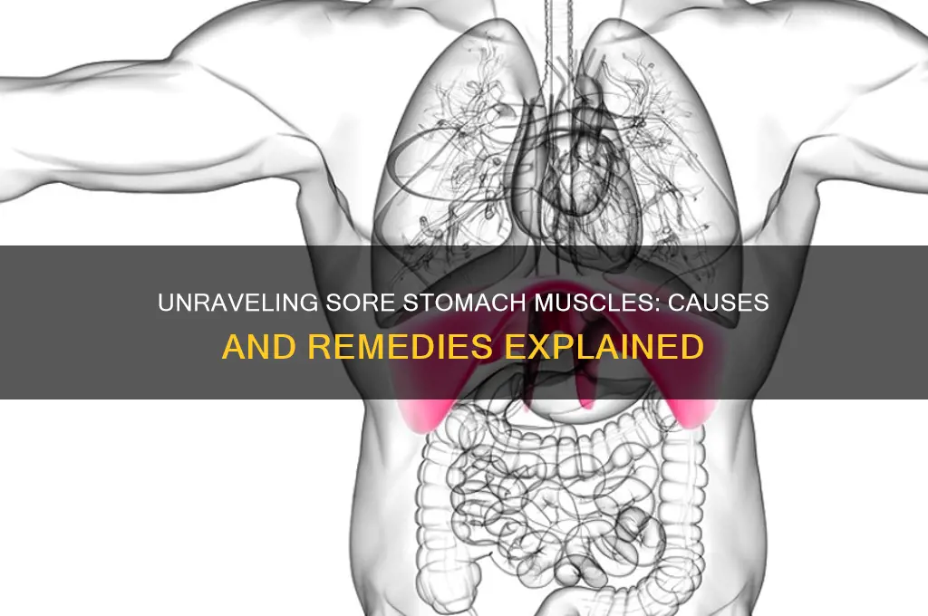 Unraveling Sore Stomach Muscles: Causes And Remedies Explained | CyVigor