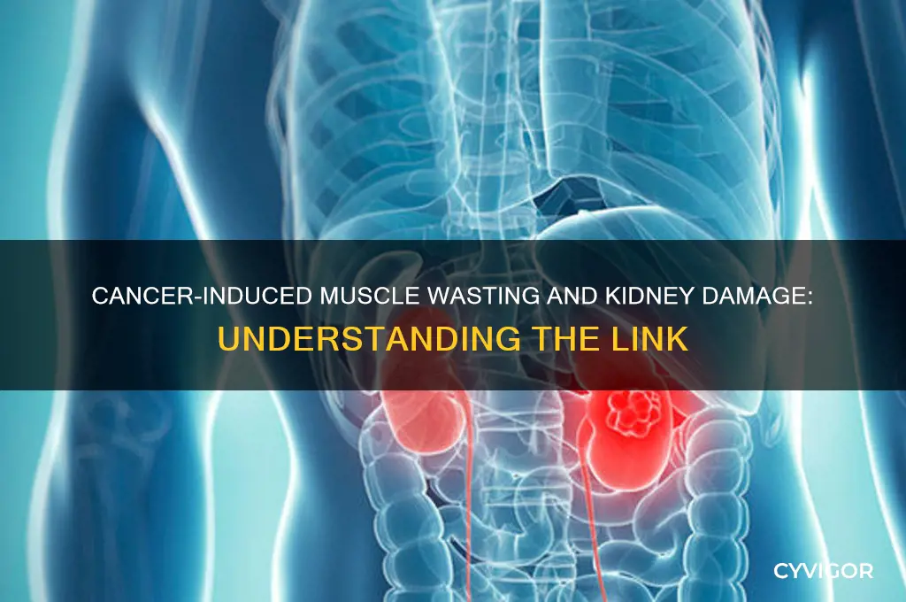 Cancer-Induced Muscle Wasting And Kidney Damage: Understanding The Link ...