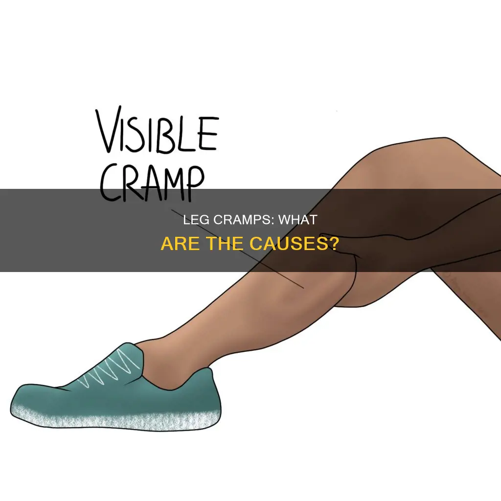 Leg Cramps: What Are The Causes? | CyVigor