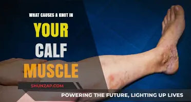 Understanding The Causes Of A Dent In Your Calf Muscle | CyVigor