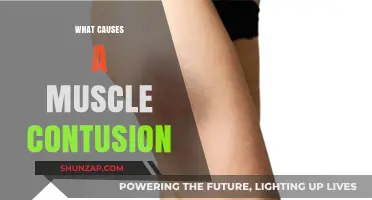 Understanding Arm Muscle Spasms: Causes And Triggers Explained | CyVigor
