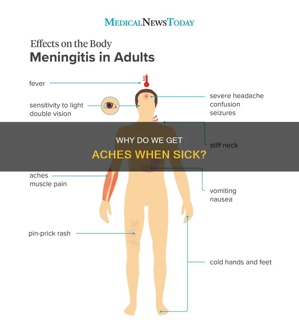 Why Do We Get Aches When Sick? | CyVigor