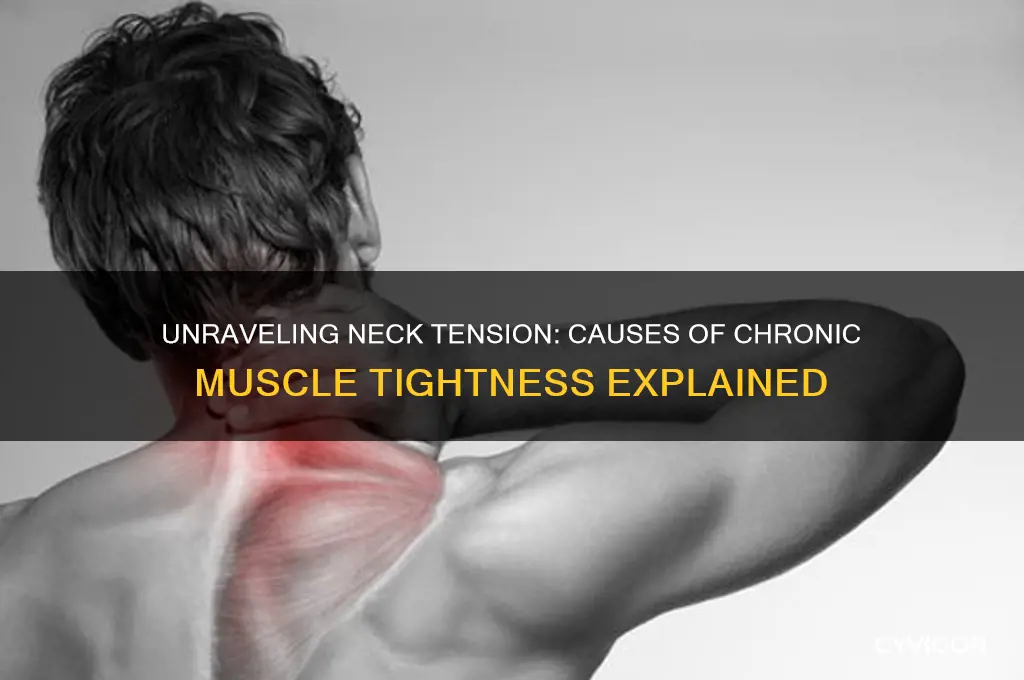 Unraveling Neck Tension: Causes Of Chronic Muscle Tightness Explained ...