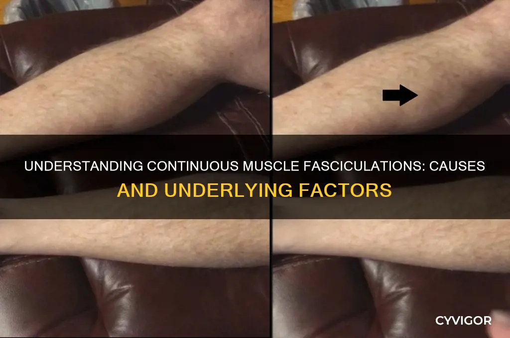 Understanding Continuous Muscle Fasciculations: Causes And Underlying ...
