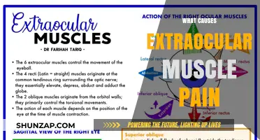 Understanding Eye Muscle Pain: Causes, Symptoms, And Relief Options ...