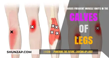 Understanding Flaccid Muscle Tone: Causes And Contributing Factors ...