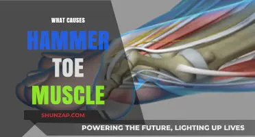 Understanding Generalized Muscle Weakness: Causes, Symptoms, And ...