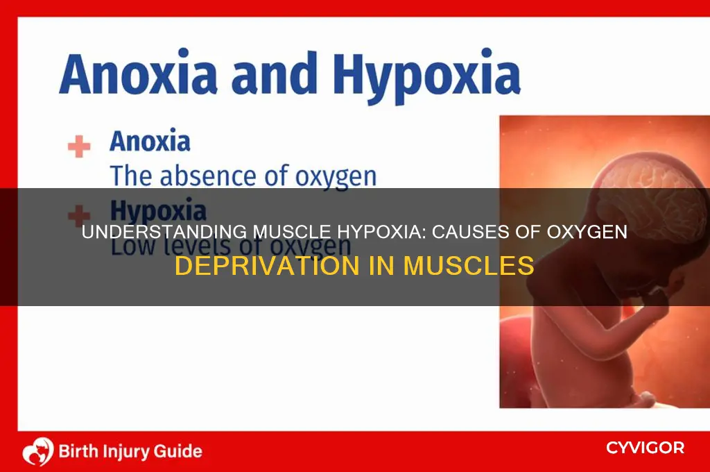 Understanding Muscle Hypoxia: Causes Of Oxygen Deprivation In Muscles ...