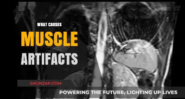 Why Muscles And Joints Ache More At Night: Causes Explained | CyVigor