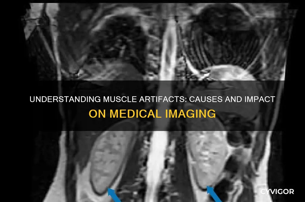 Understanding Muscle Artifacts: Causes And Impact On Medical Imaging ...