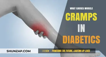 Understanding Dialysis-Related Muscle Cramps: Causes And Prevention ...
