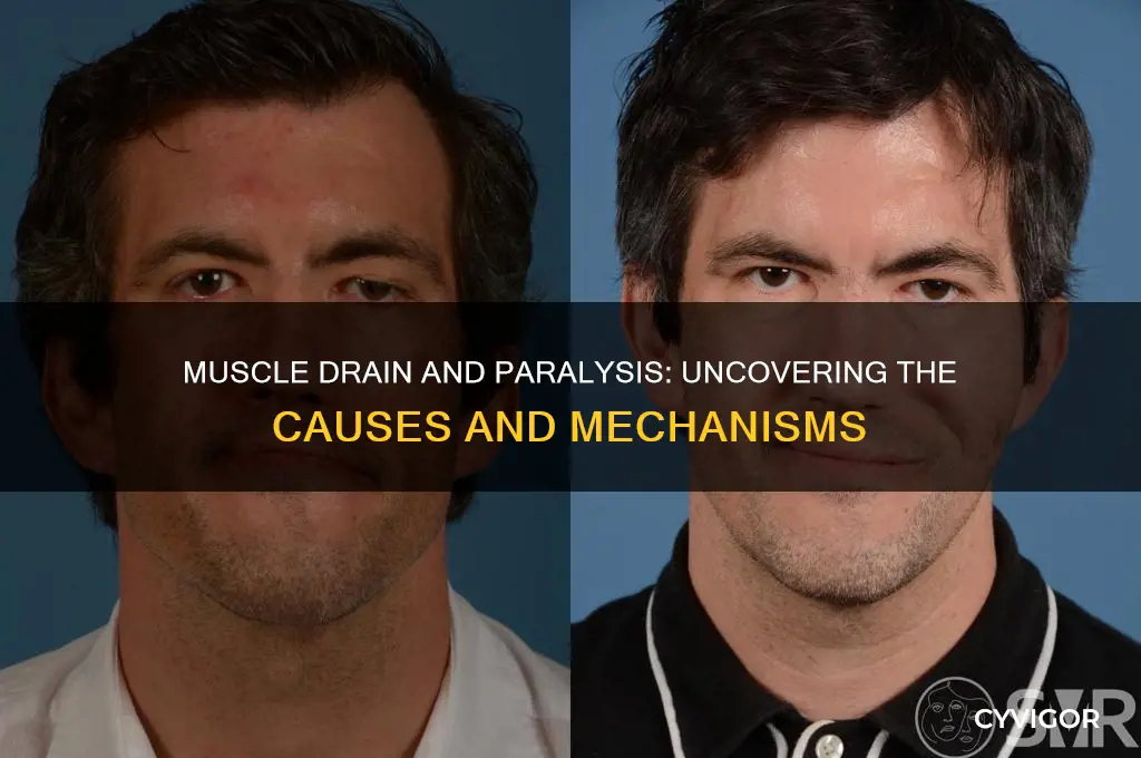 Muscle Drain And Paralysis: Uncovering The Causes And Mechanisms | CyVigor