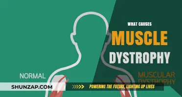 Understanding Muscle Deconditioning: Causes And Impact On Physical ...