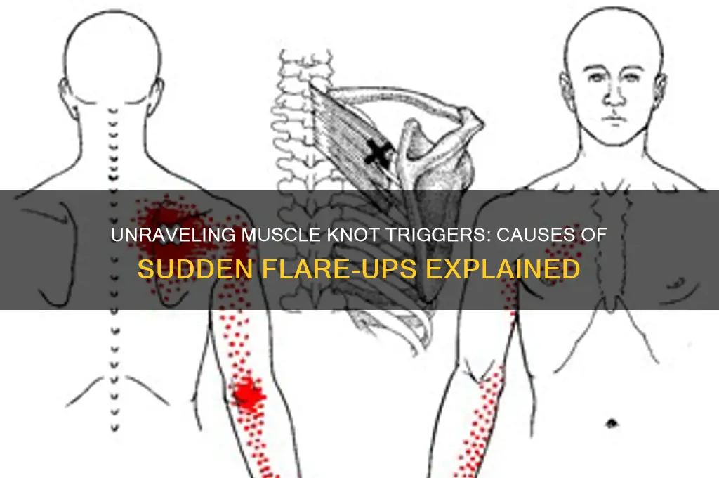 Unraveling Muscle Knot Triggers: Causes Of Sudden Flare-Ups Explained ...