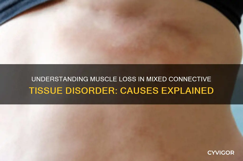 Understanding Muscle Loss In Mixed Connective Tissue Disorder: Causes ...