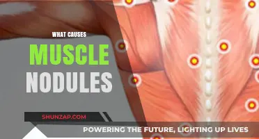 Understanding The Science Behind Muscle Movement: Causes And Mechanisms ...