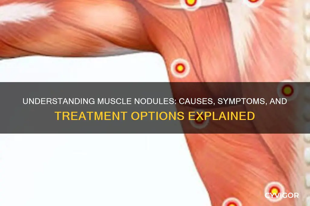 Understanding Muscle Nodules: Causes, Symptoms, And Treatment Options ...