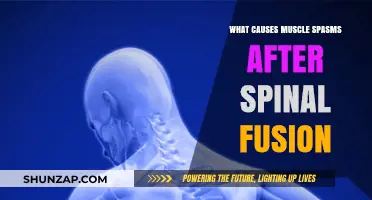 Understanding Post-Spinal Surgery Muscle Spasms: Causes And Relief ...