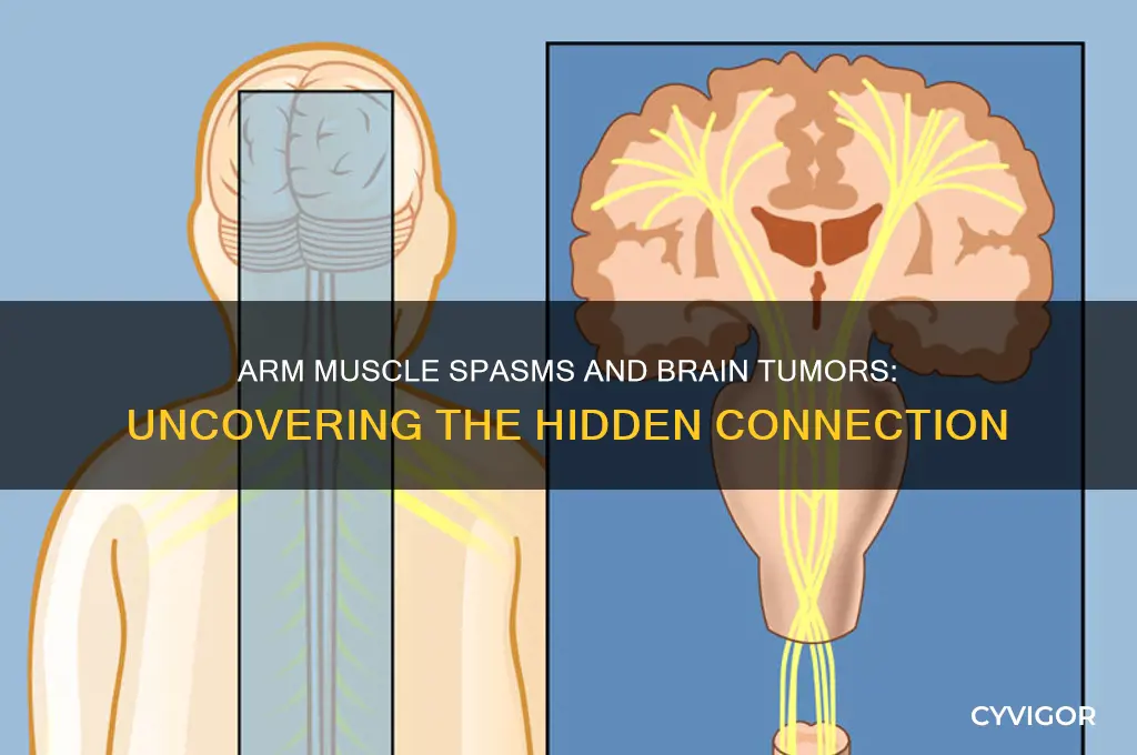 Arm Muscle Spasms And Brain Tumors: Uncovering The Hidden Connection ...