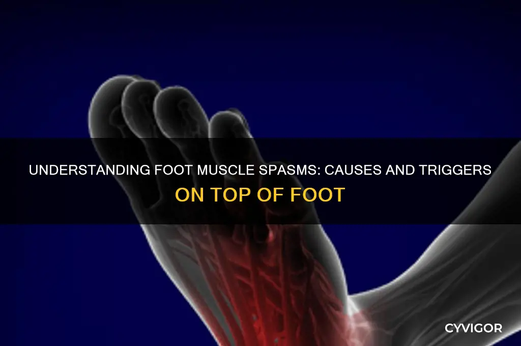 Understanding Foot Muscle Spasms: Causes And Triggers On Top Of Foot ...