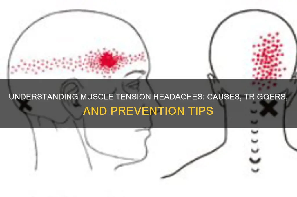 Understanding Muscle Tension Headaches: Causes, Triggers, And ...