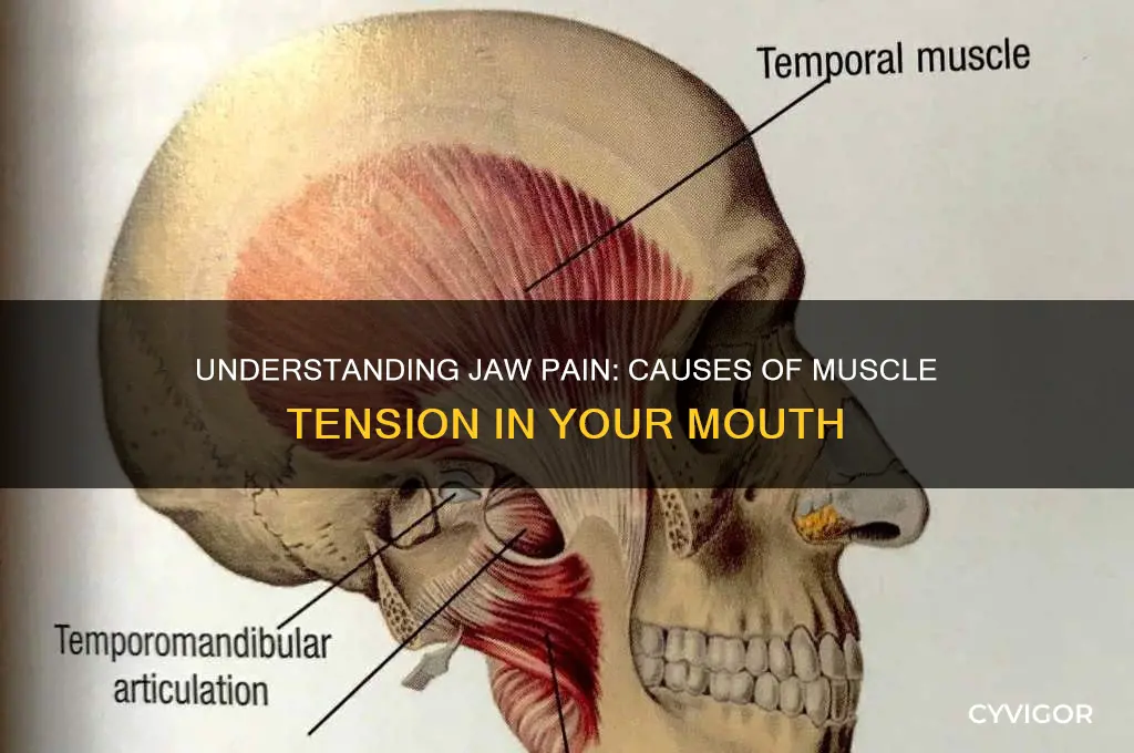Understanding Jaw Pain: Causes Of Muscle Tension In Your Mouth | CyVigor