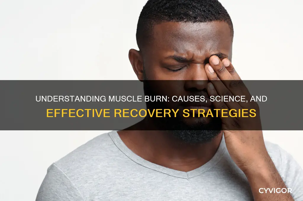 Understanding Muscle Burn: Causes, Science, And Effective Recovery ...