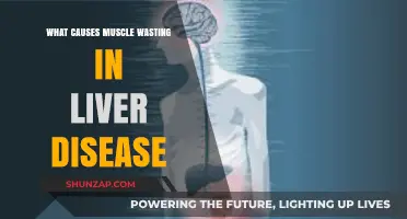 Understanding Muscle Wasting In Diabetes: Causes And Prevention ...