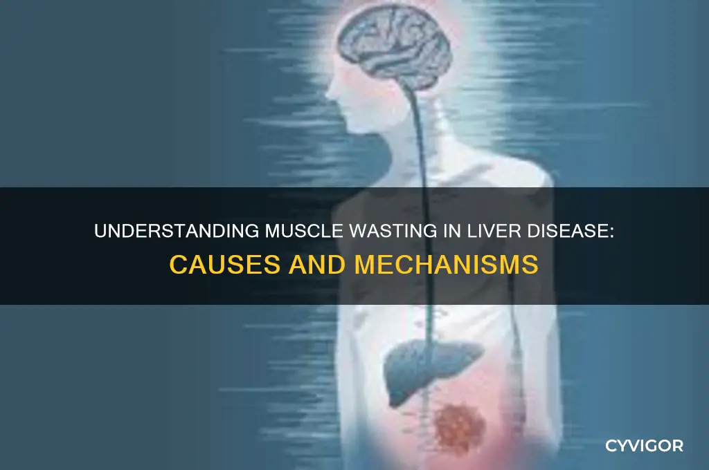Understanding Muscle Wasting In Liver Disease: Causes And Mechanisms ...