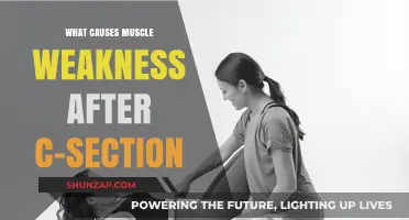 Understanding Post-Stroke Muscle Weakness: Causes And Recovery Insights ...