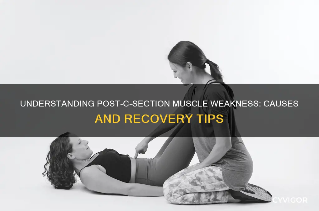 Understanding Post-C-Section Muscle Weakness: Causes And Recovery Tips ...