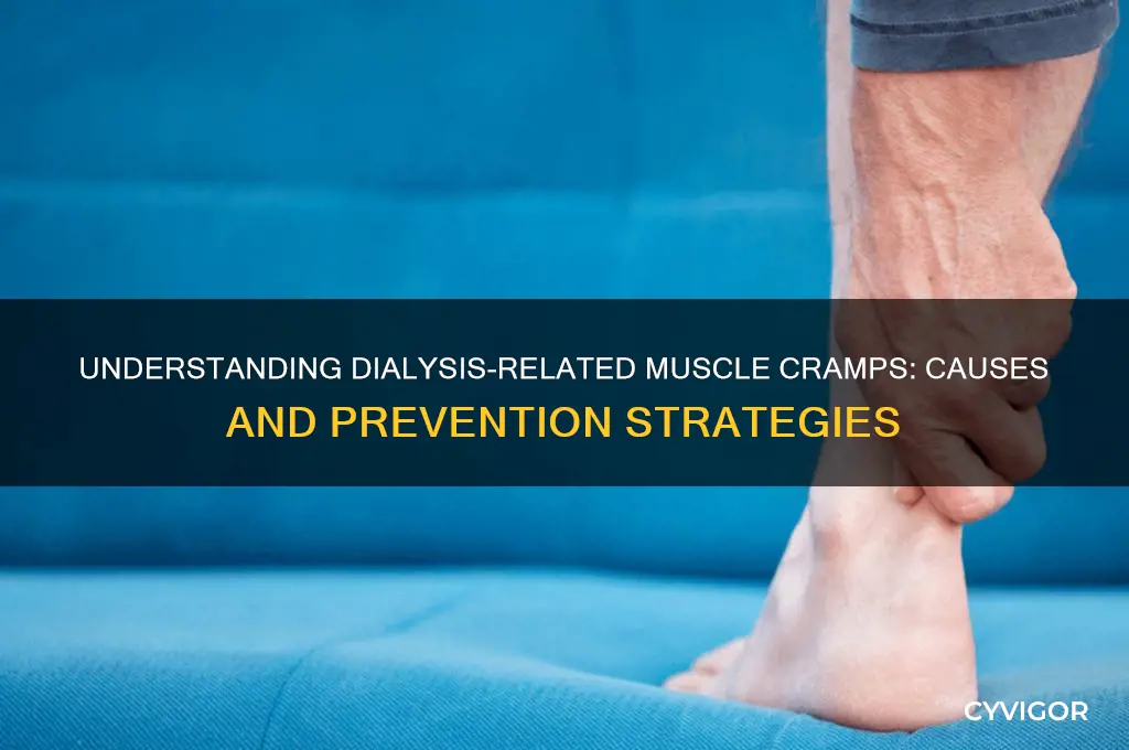 Understanding Dialysis-Related Muscle Cramps: Causes And Prevention ...