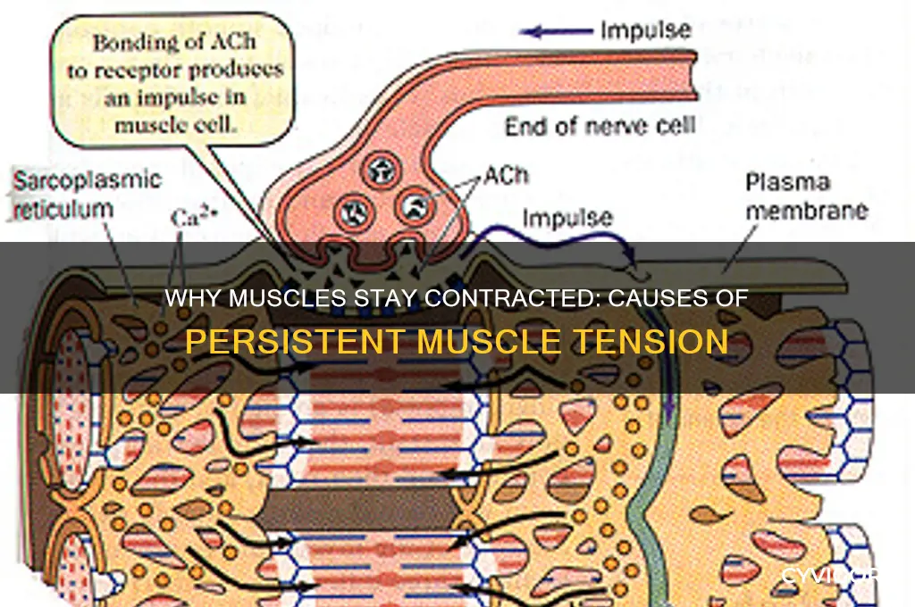 Why Muscles Stay Contracted: Causes Of Persistent Muscle Tension | CyVigor