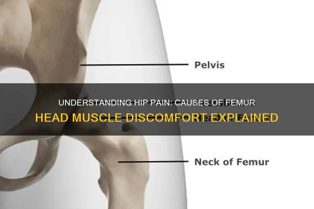 Understanding Hip Pain: Causes Of Femur Head Muscle Discomfort ...