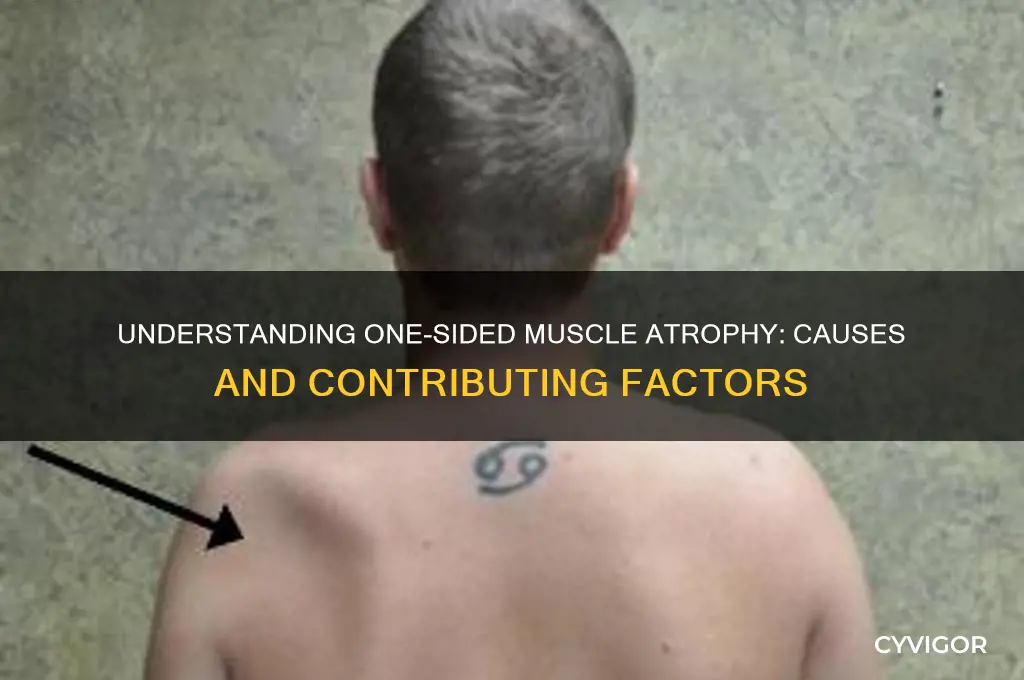 Understanding One-Sided Muscle Atrophy: Causes And Contributing Factors ...