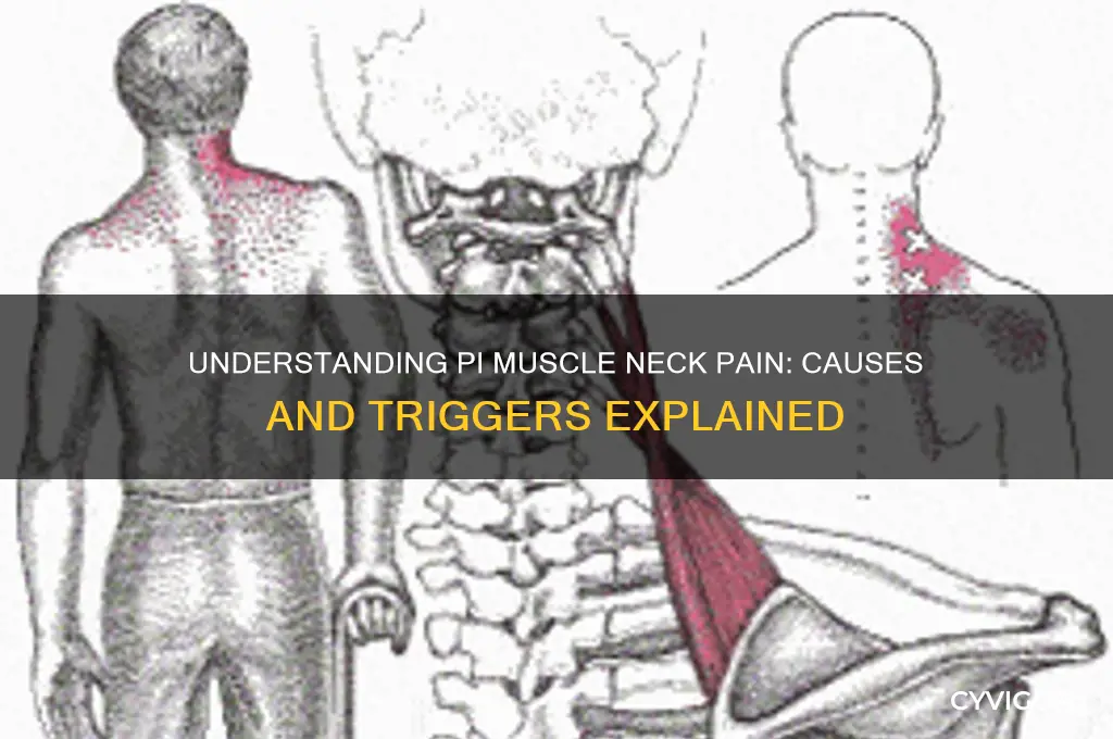 Understanding Pi Muscle Neck Pain: Causes And Triggers Explained | CyVigor