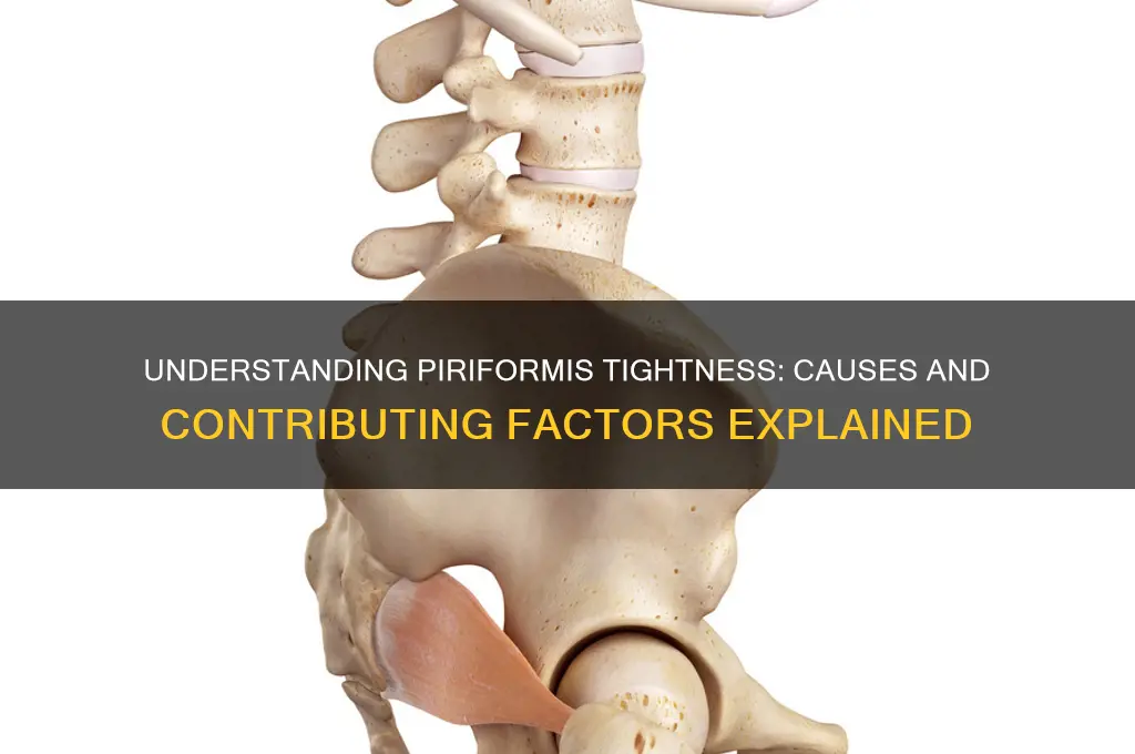Understanding Piriformis Tightness: Causes And Contributing Factors ...