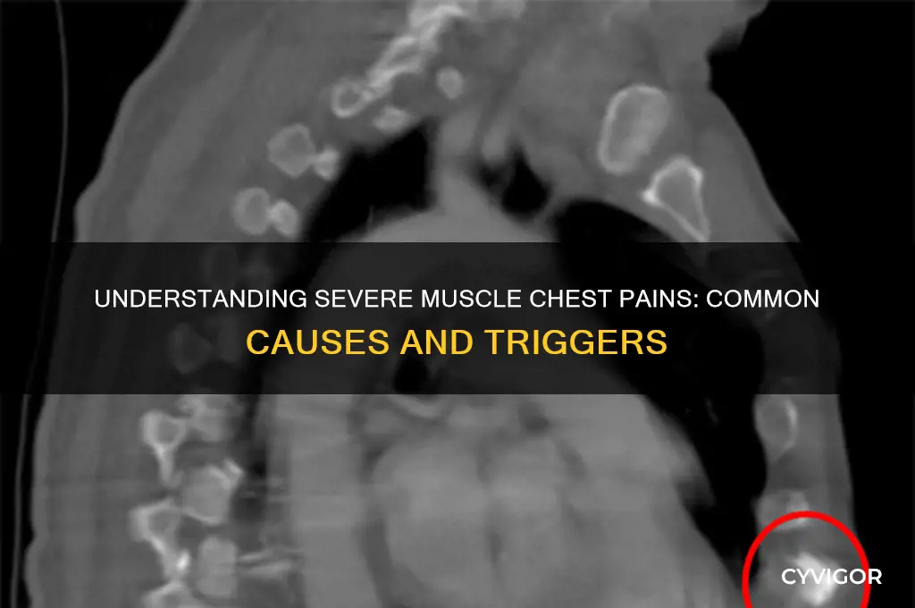 Understanding Severe Muscle Chest Pains: Common Causes And Triggers ...