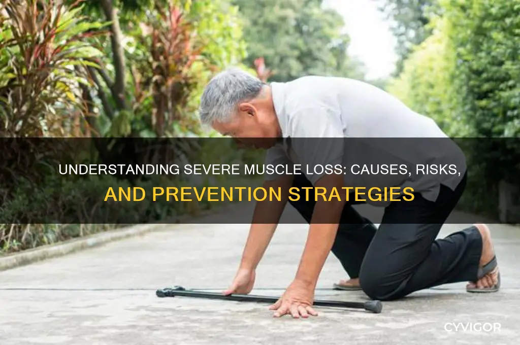 Understanding Severe Muscle Loss: Causes, Risks, And Prevention ...