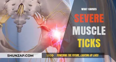 Understanding Severe Upper Back And Shoulder Pain: Common Causes ...