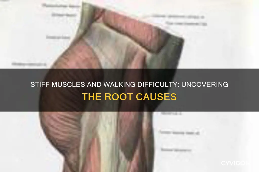 Stiff Muscles And Walking Difficulty: Uncovering The Root Causes | CyVigor