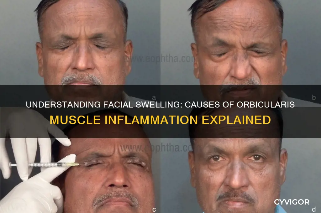 Understanding Facial Swelling: Causes Of Orbicularis Muscle ...