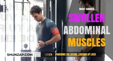 Understanding Swollen Scm Muscle: Causes, Symptoms, And Treatment ...