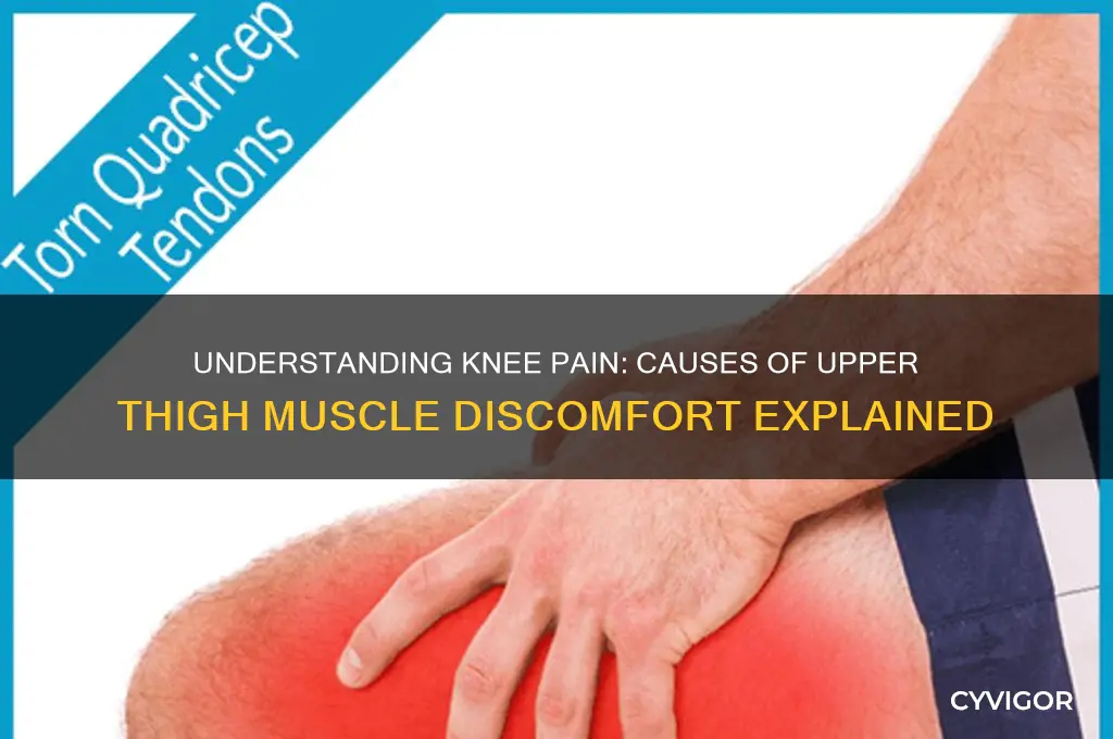 Understanding Knee Pain: Causes Of Upper Thigh Muscle Discomfort ...
