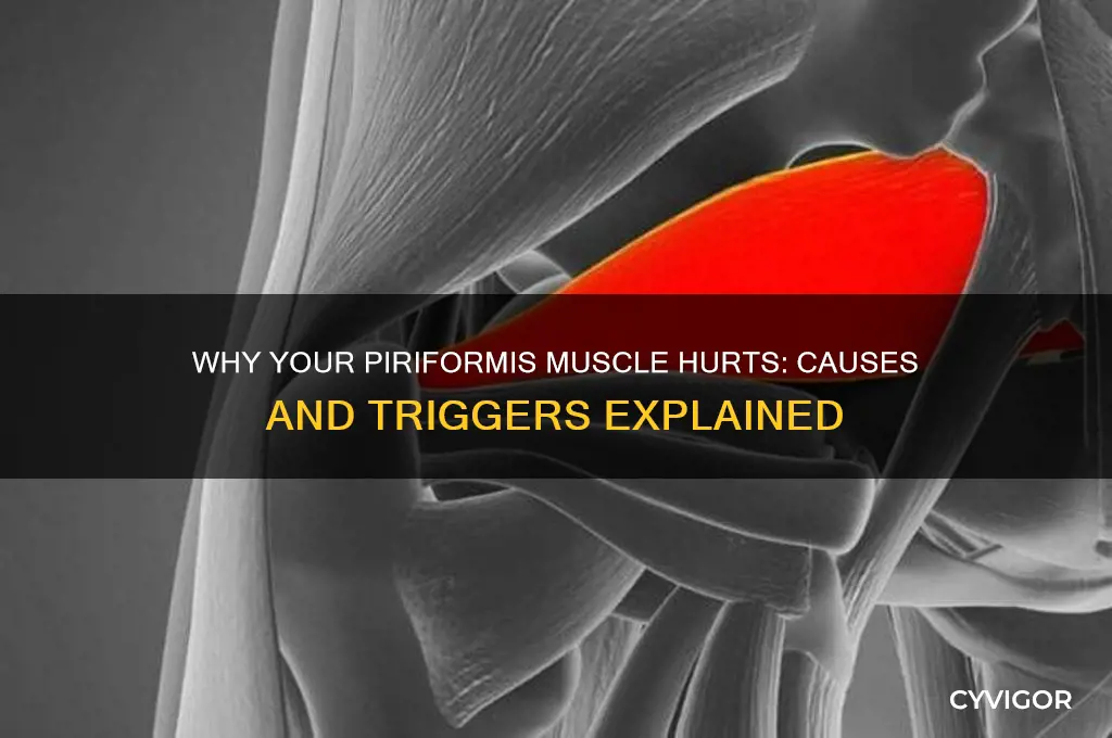 Why Your Piriformis Muscle Hurts: Causes And Triggers Explained | CyVigor
