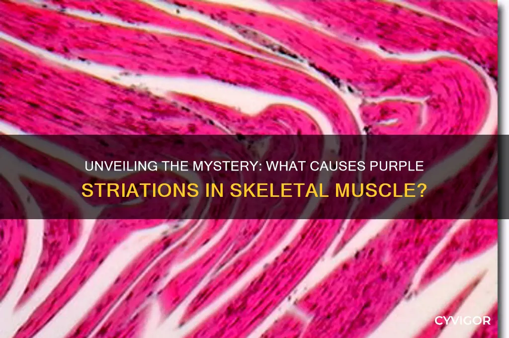 Unveiling The Mystery: What Causes Purple Striations In Skeletal Muscle ...