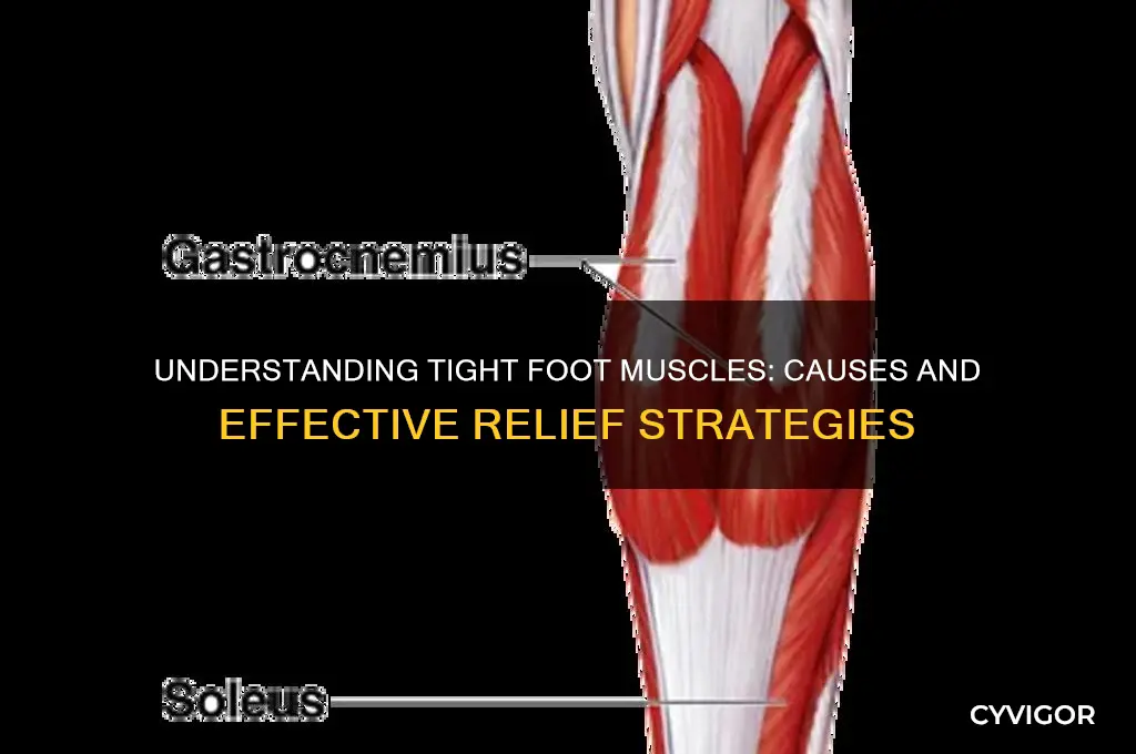 Understanding Tight Foot Muscles: Causes And Effective Relief ...